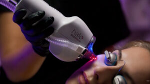 HALO® TRIBRID™ | Dermatology Associates Skin & Cancer